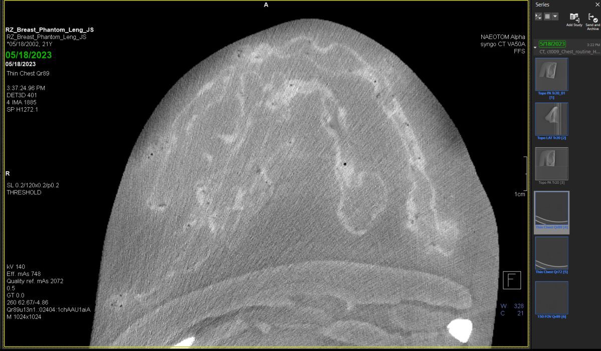 Breast Phantom for Medical Imaging – inmed.com.au