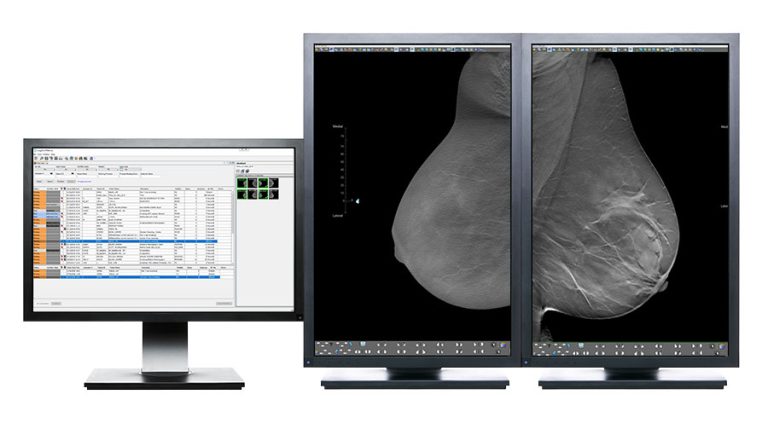 ImageView Advanced Mammography Viewer – inmed.com.au